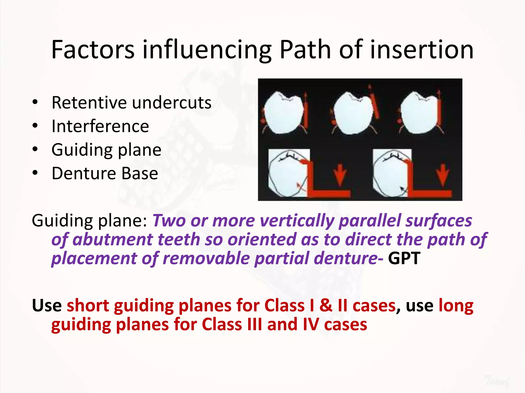 Designing a Removable Partial Denture (Kennedy's Classification) | PPTX