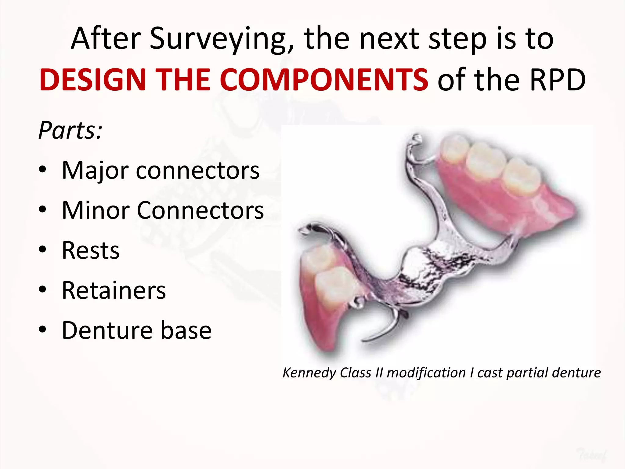 Designing a Removable Partial Denture (Kennedy's Classification) | PPTX