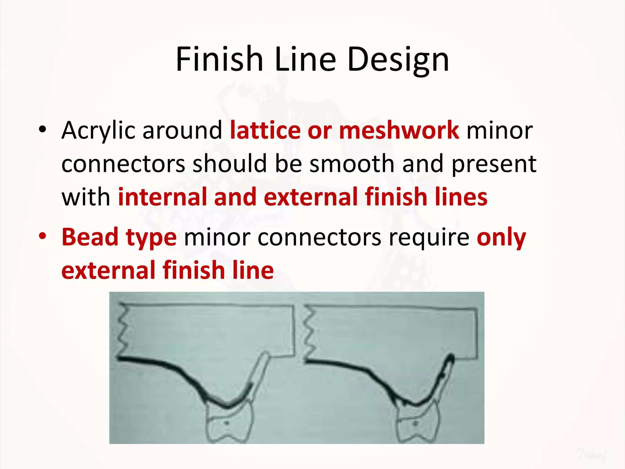 Designing a Removable Partial Denture (Kennedy's Classification) | PPTX