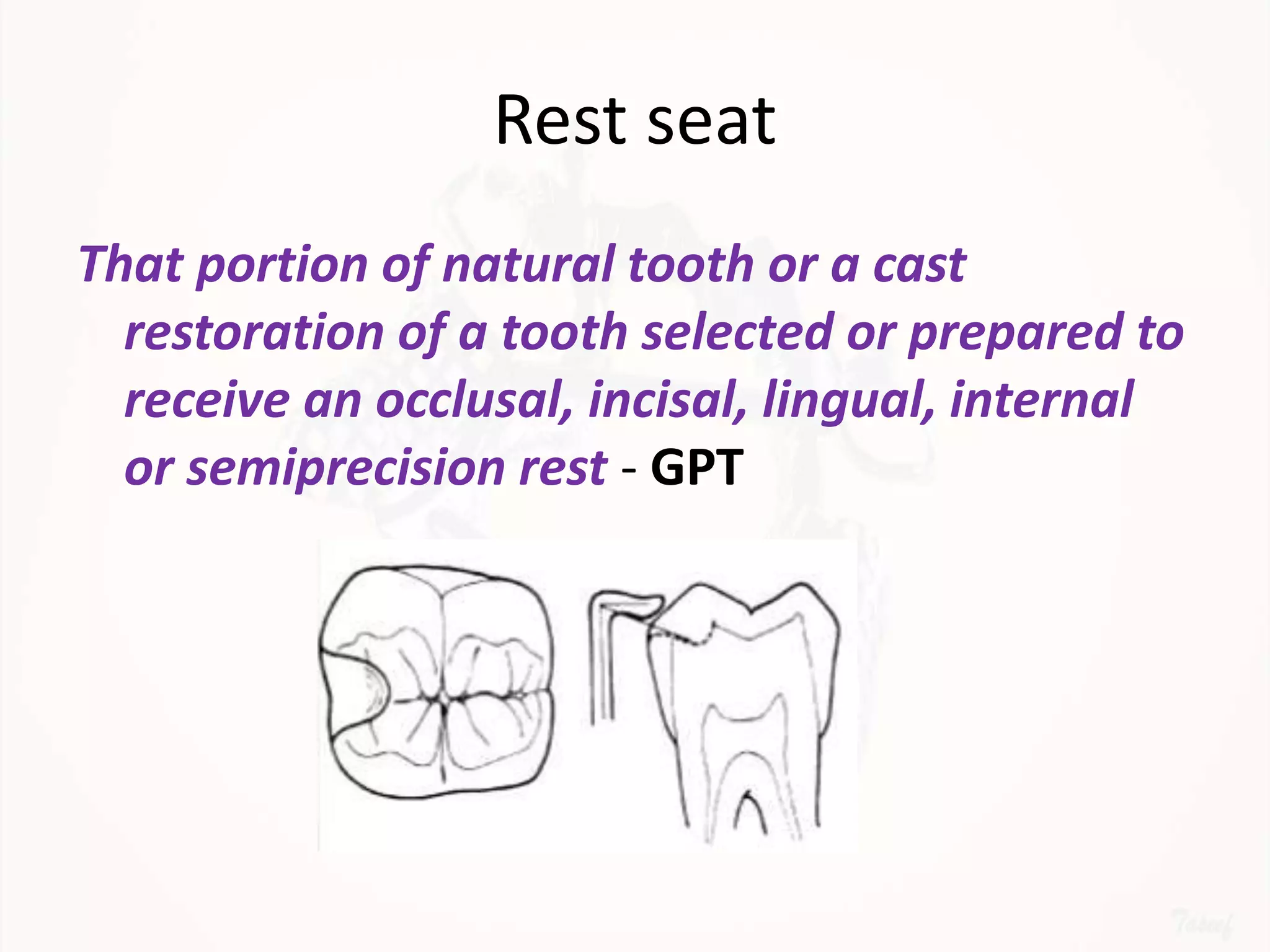 Designing a Removable Partial Denture (Kennedy's Classification) | PPTX