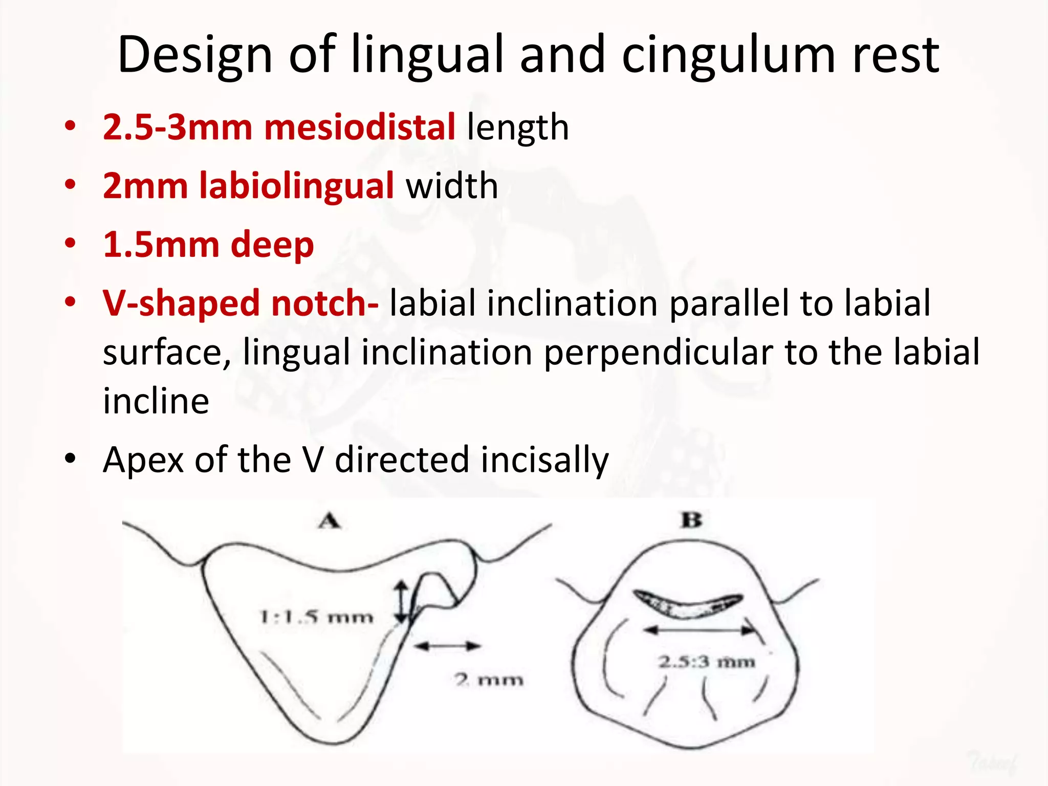 Designing a Removable Partial Denture (Kennedy's Classification) | PPTX