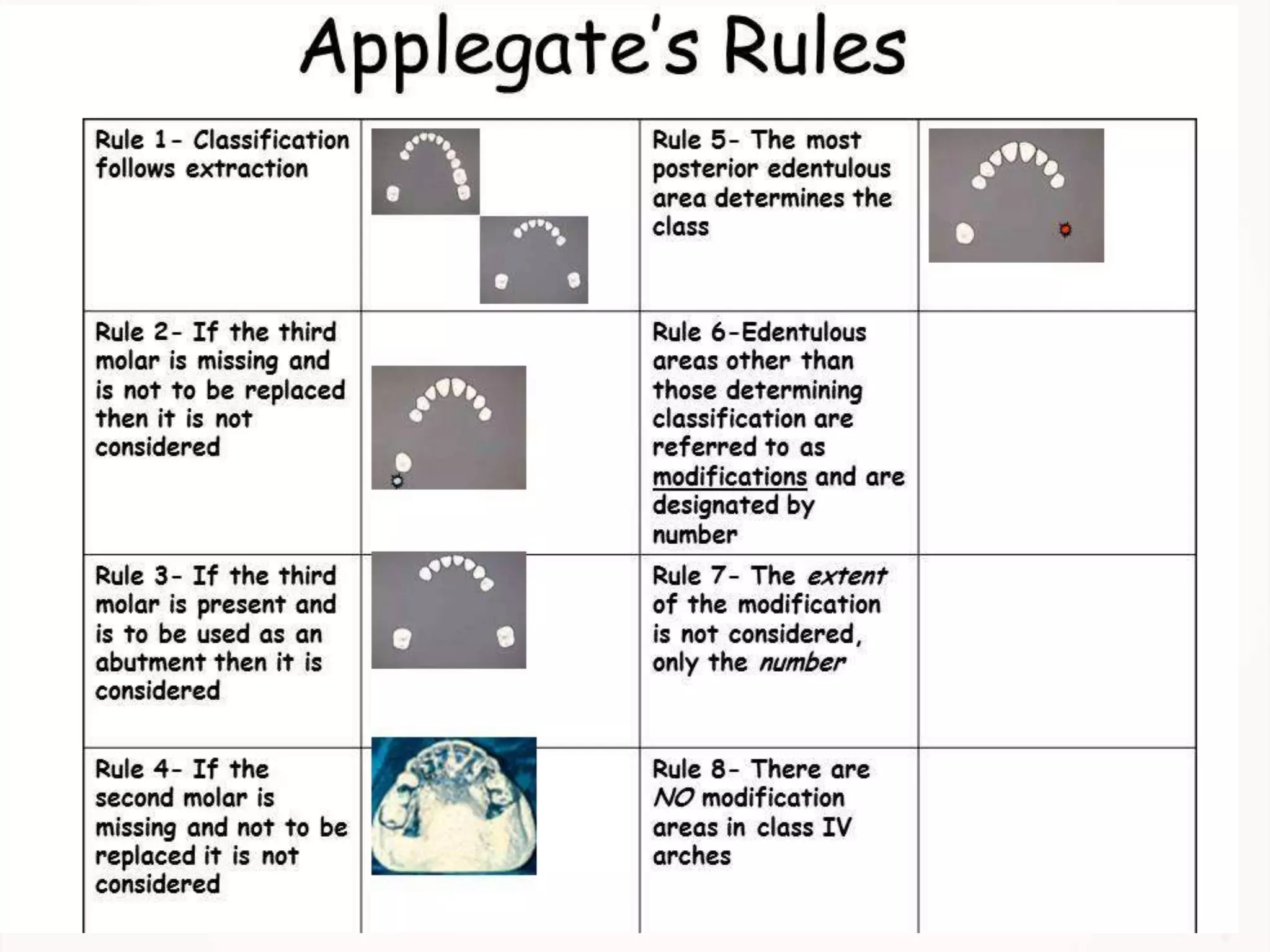 Designing a Removable Partial Denture (Kennedy's Classification) | PPTX