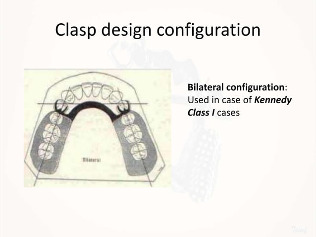 Designing a Removable Partial Denture (Kennedy's Classification) | PPTX