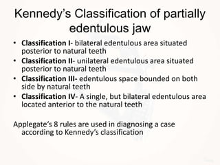 Designing a Removable Partial Denture (Kennedy's Classification) | PPT