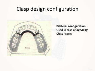 Designing a Removable Partial Denture (Kennedy's Classification) | PPT