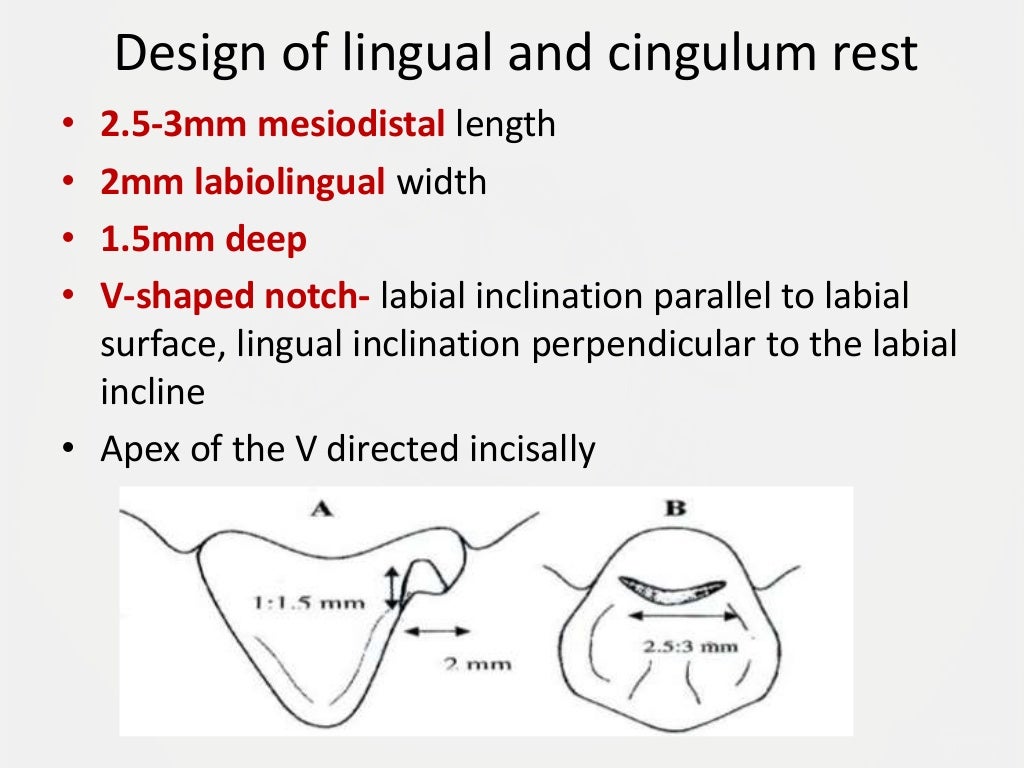 Designing a Removable Partial Denture (Kennedy's Classification)