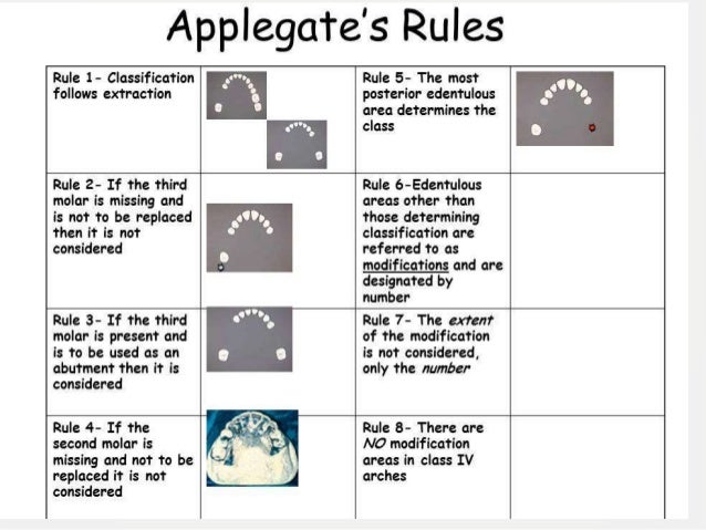 Designing a Removable Partial Denture (Kennedy's Classification)