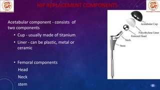 Design of durable total hip replacement athroplasty implant | PPTX