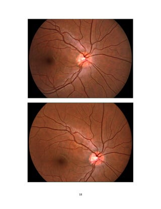 Design of imaging system of fundus camera.pdf