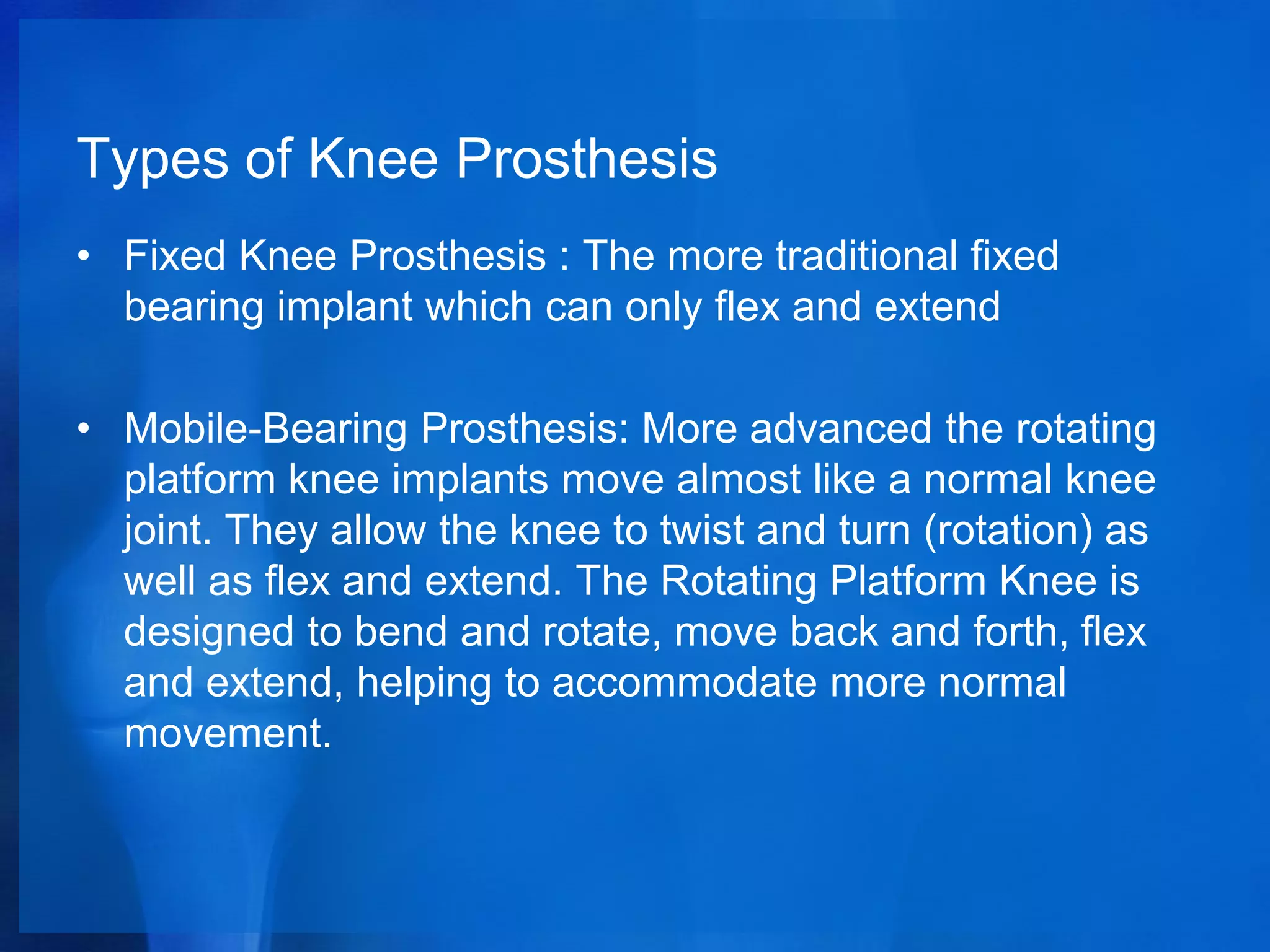 Design Of Knee Prosthesis and Analysis-Ashish Sharma | PDF