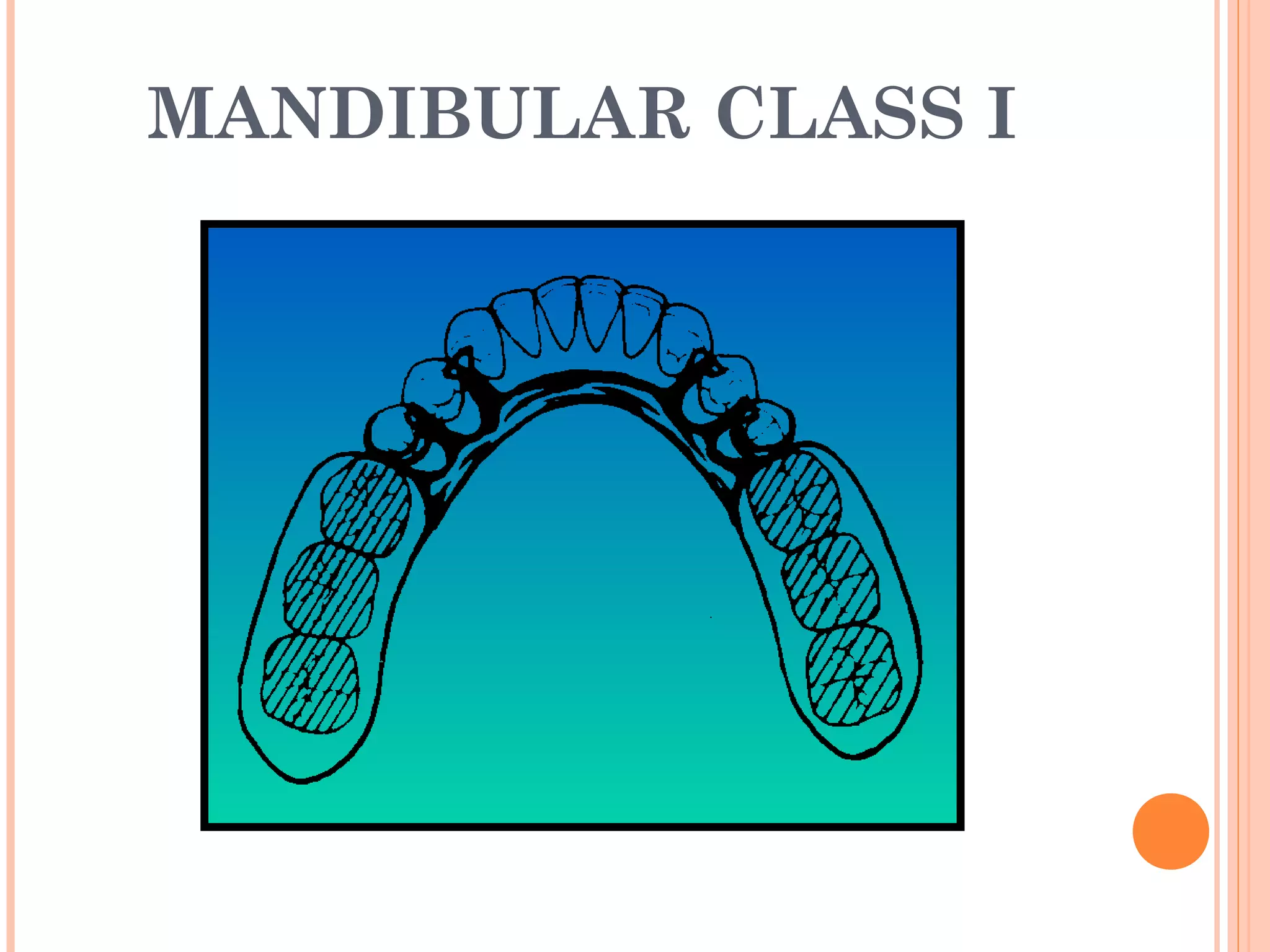 Design of removable partial denture | PPT