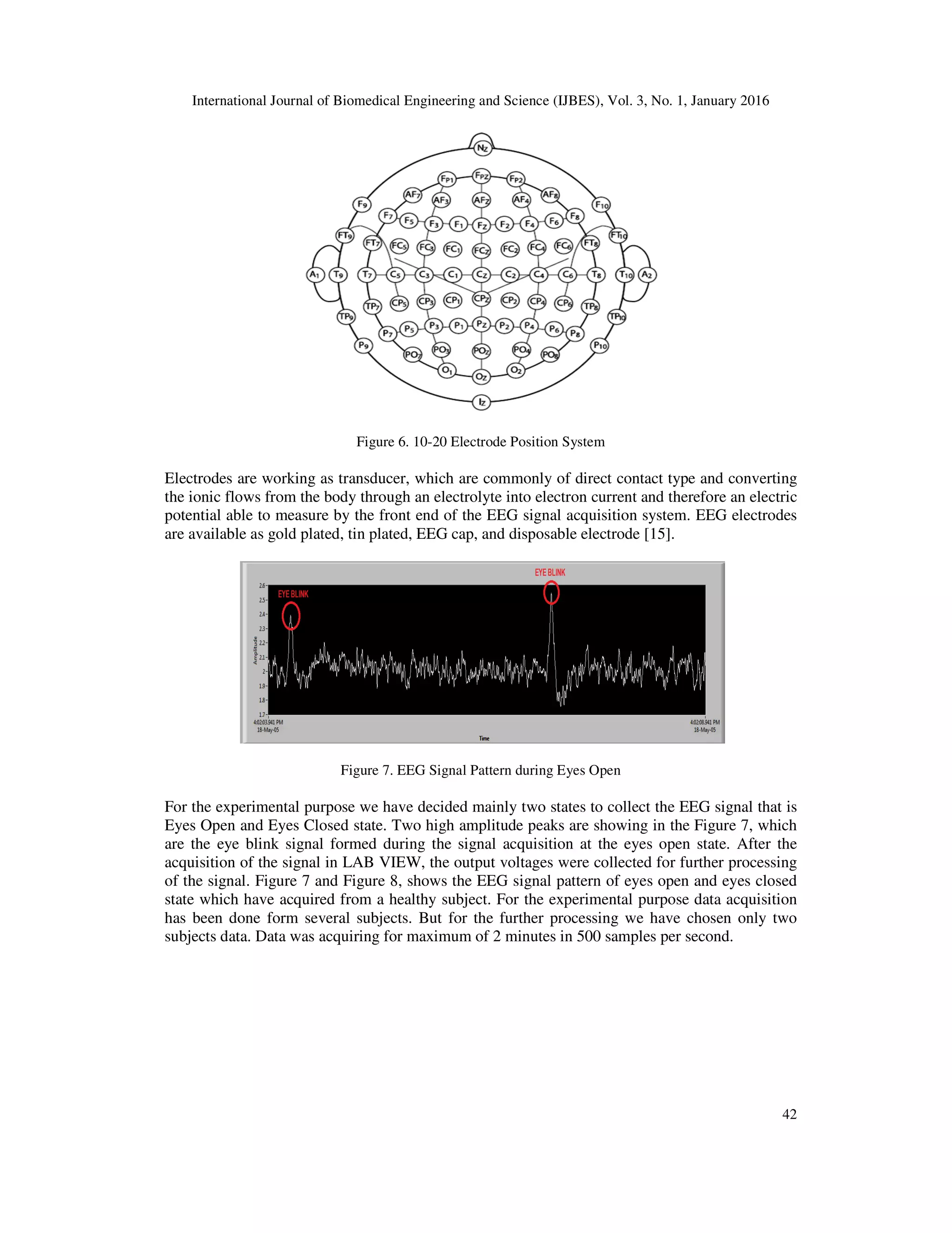 Design of single channel portable eeg | PDF