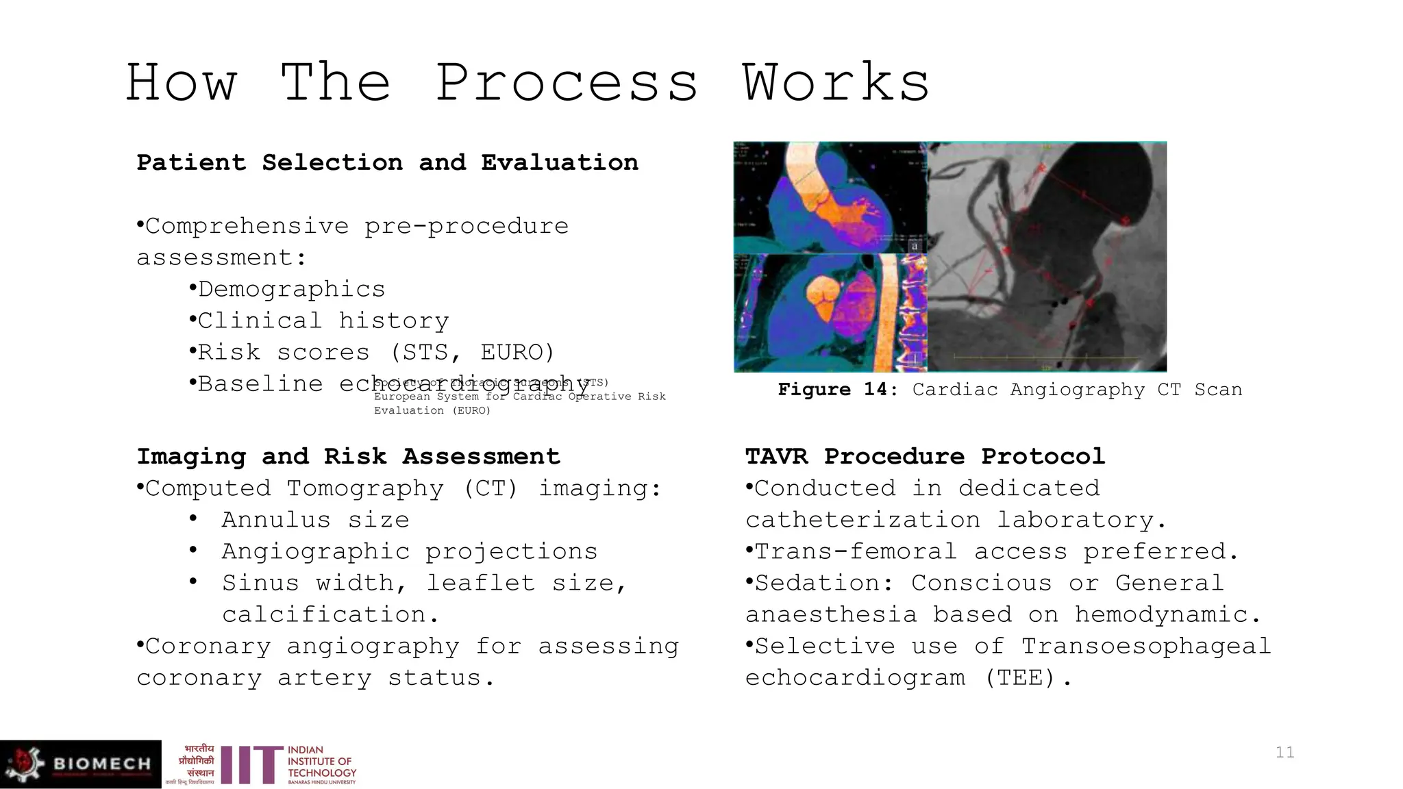 DESIGN OF TRANS-CATHETER AORTIC VALVE REPLACEMENT (TAVR).pptx