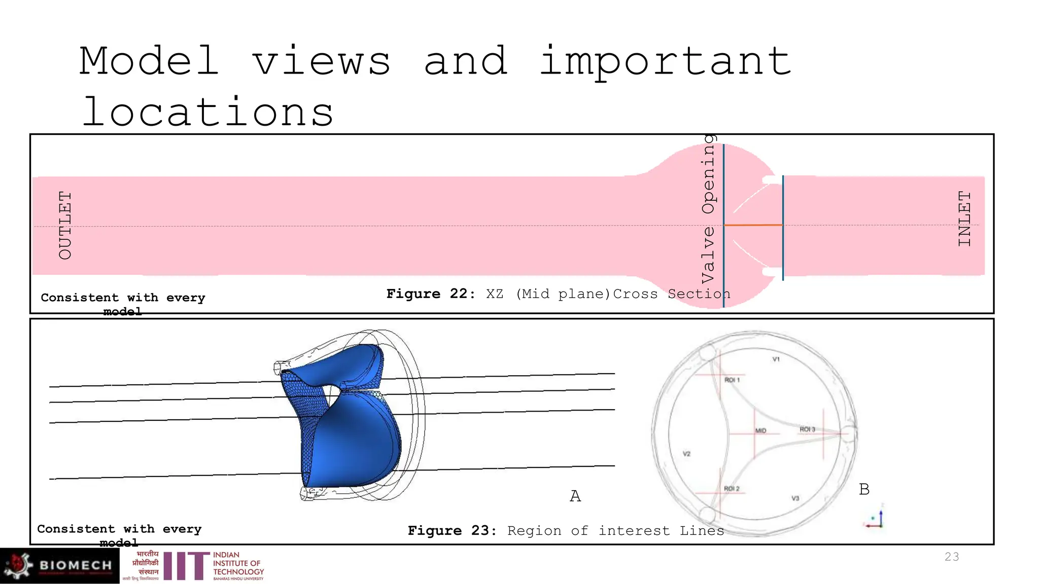 DESIGN OF TRANS-CATHETER AORTIC VALVE REPLACEMENT (TAVR).pptx