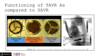 DESIGN OF TRANS-CATHETER AORTIC VALVE REPLACEMENT (TAVR).pptx