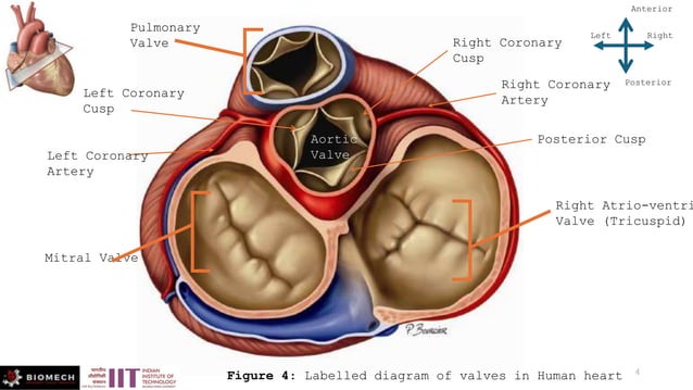 DESIGN OF TRANS-CATHETER AORTIC VALVE REPLACEMENT (TAVR).pptx