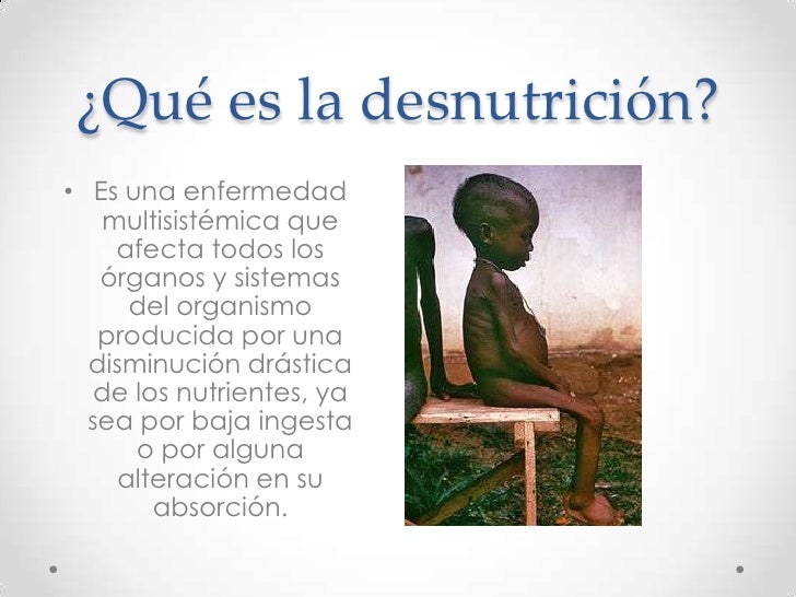 Desnutrición infantil