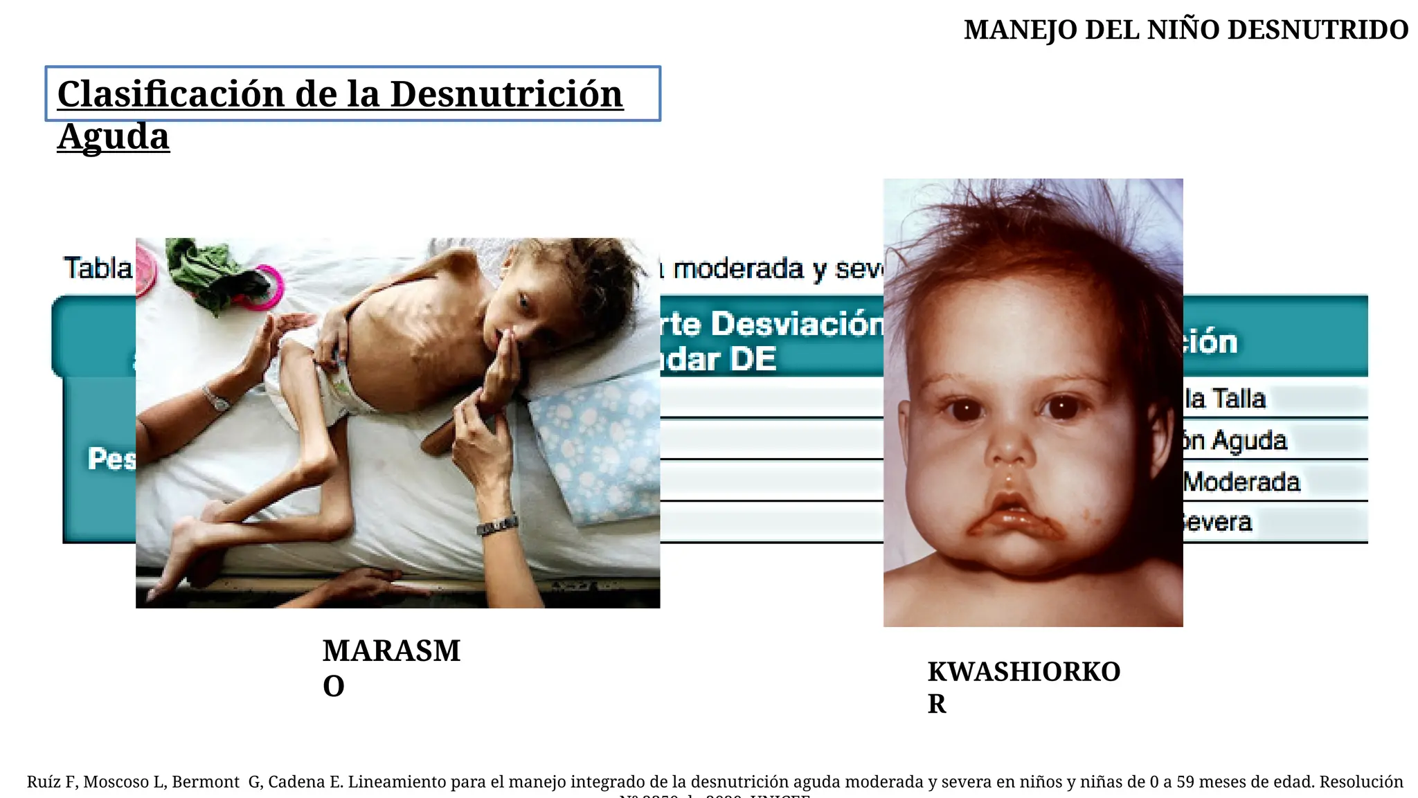 guia de DESNUTRICION.infantil.pediatria.pdf
