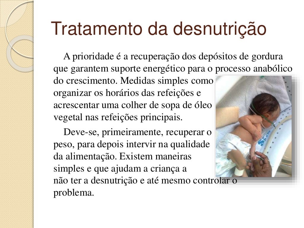 Desnutrição Infantil