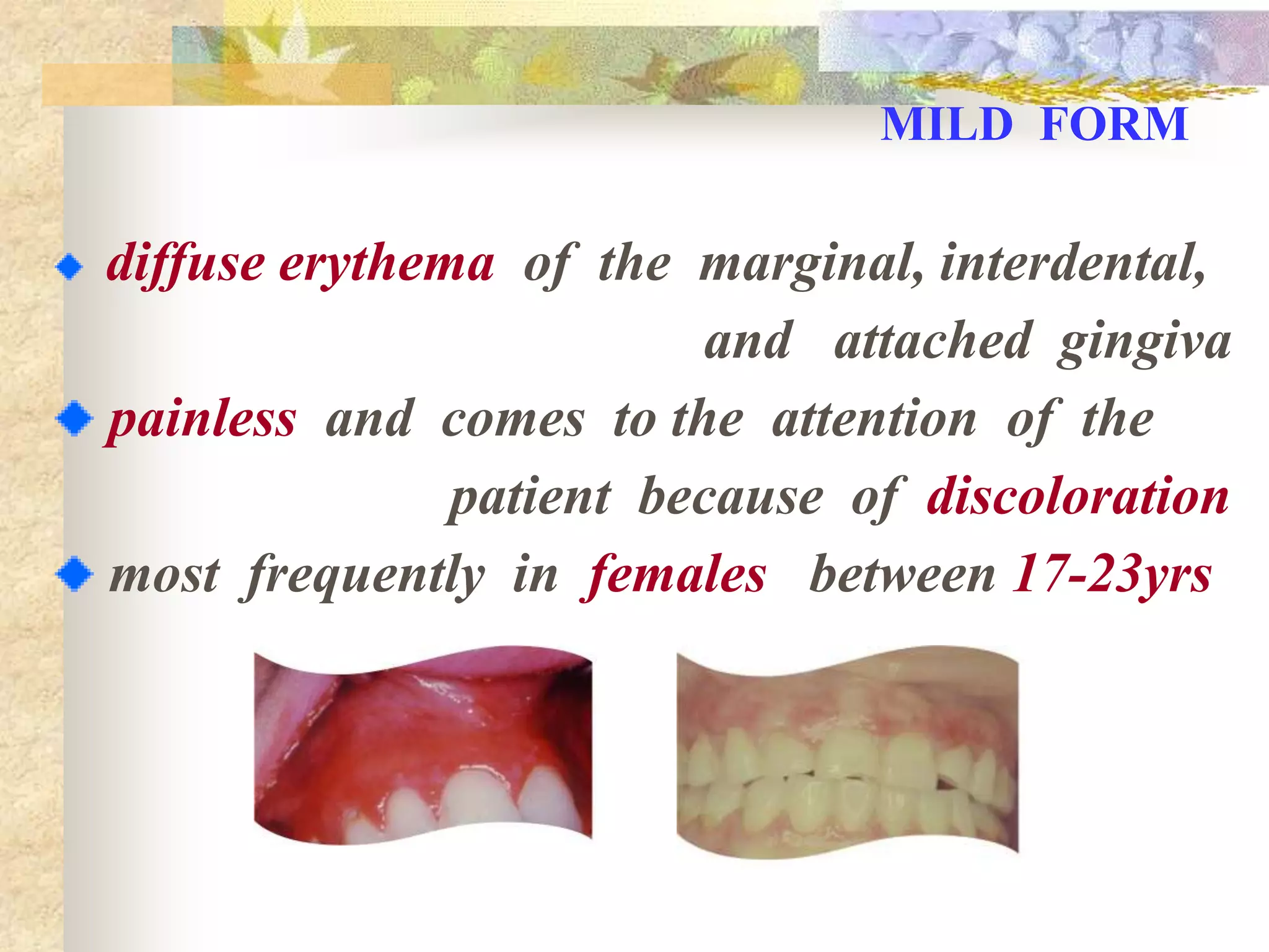 DESQUAMATIVE GINGIVITIS.ppt