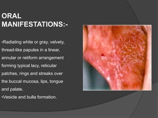 Desquamative gingivitis- lesions on the gingiva | PPTX