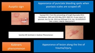 Desquamative gingivitis ppt | PPT