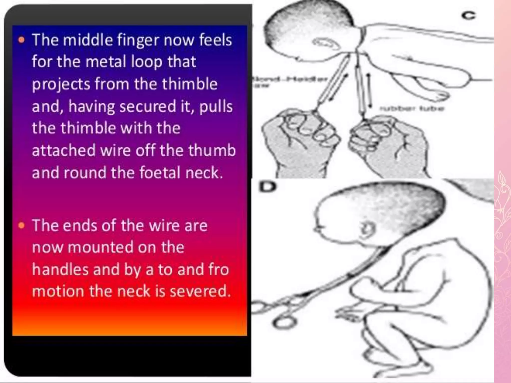 Destructive operation | PPT