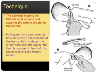 Destructive operation | PPT