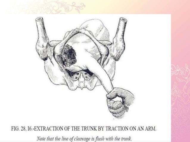 Destructive operation | PPT