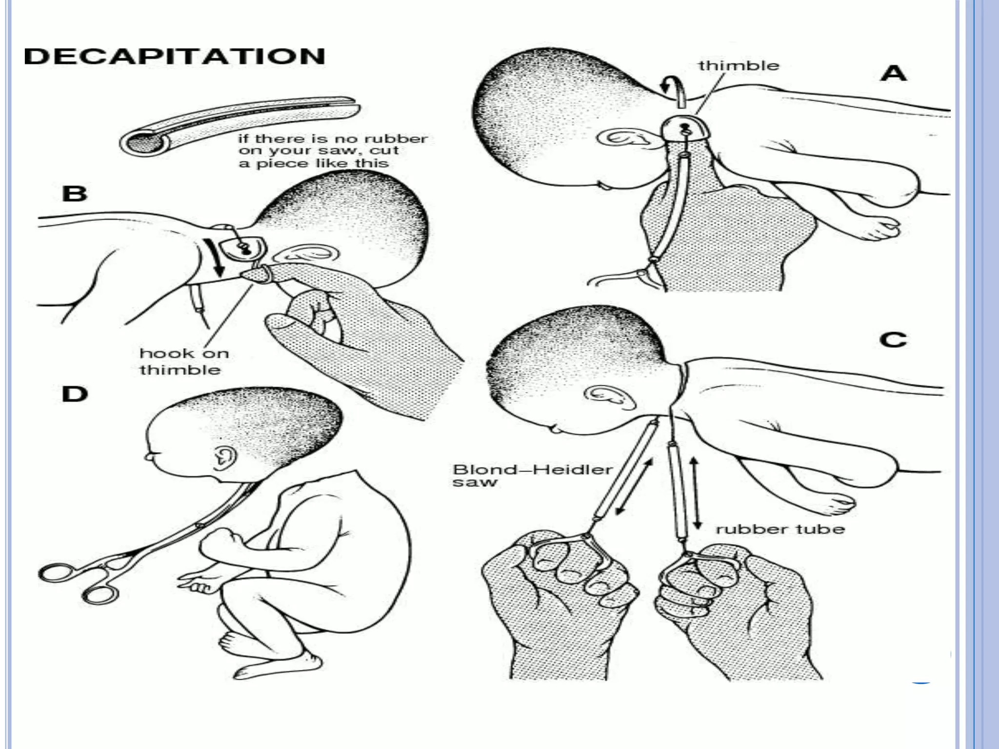 Destructive operation | PPTX