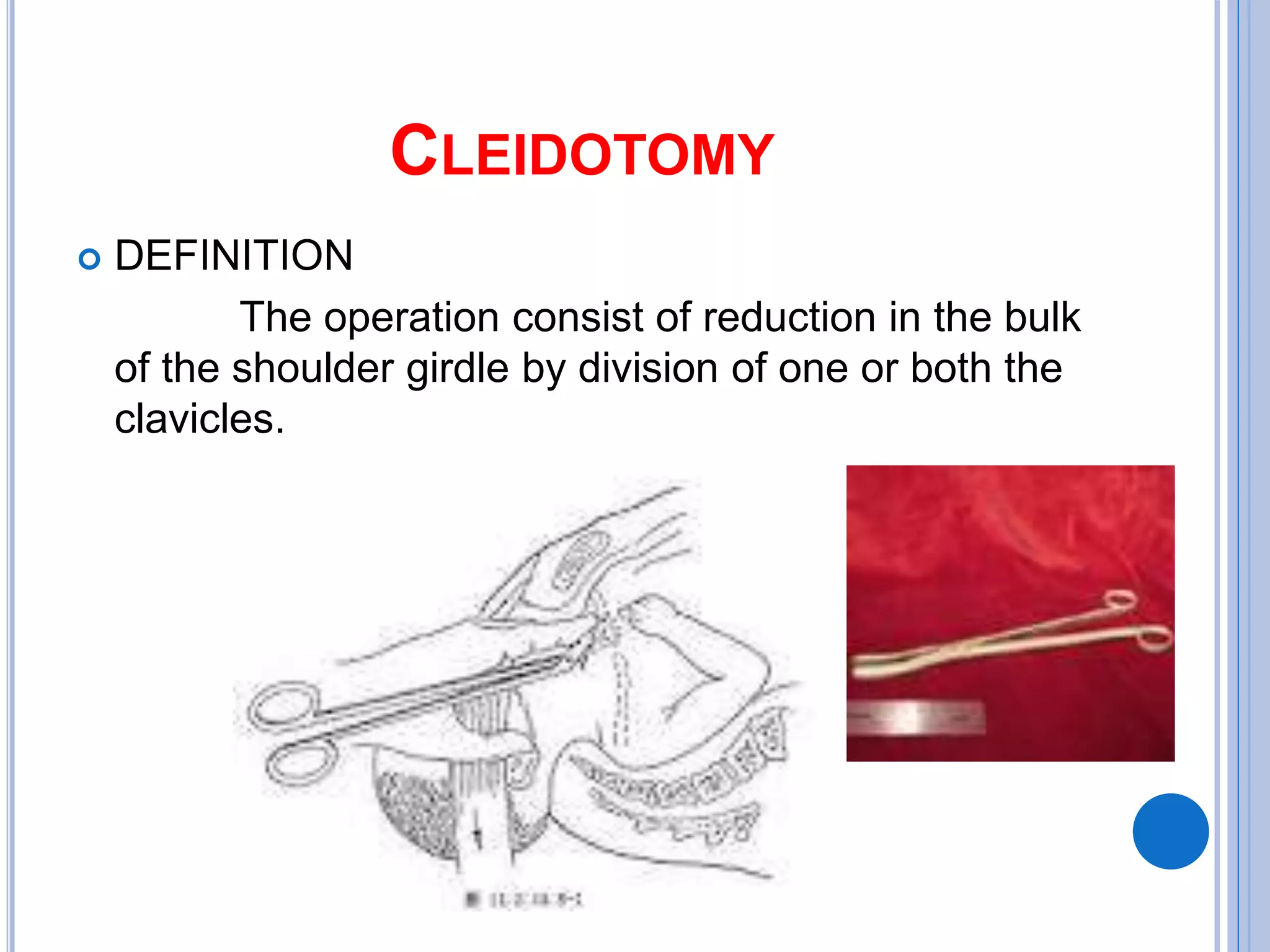 Destructive operation | PPTX
