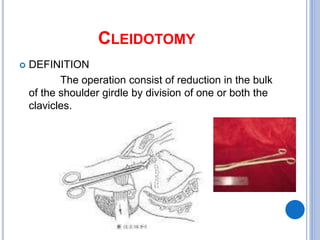 Destructive operation | PPT