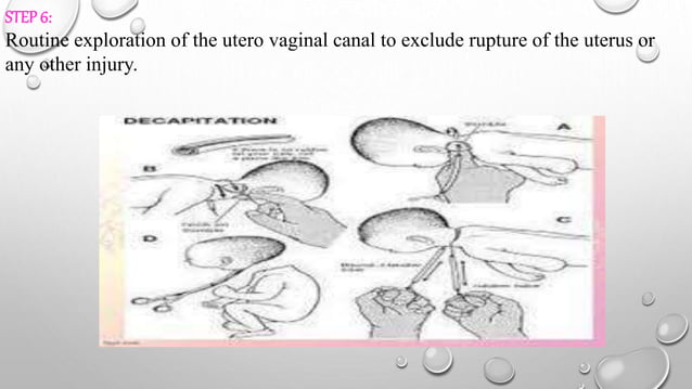 destructive operation (1).pptx