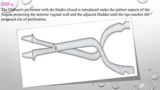 destructive operation (1).pptx
