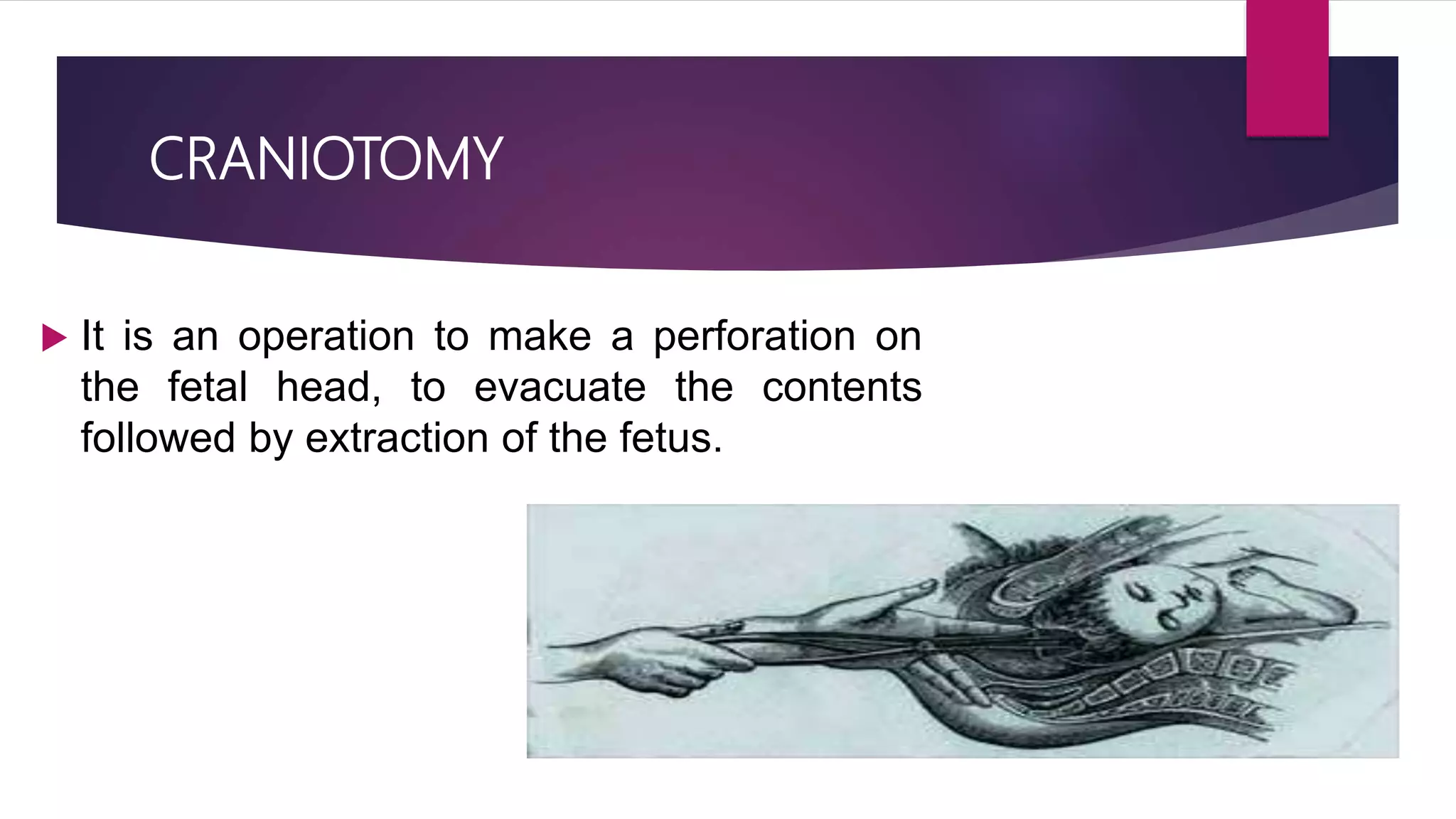 Destructive operations | PPTX