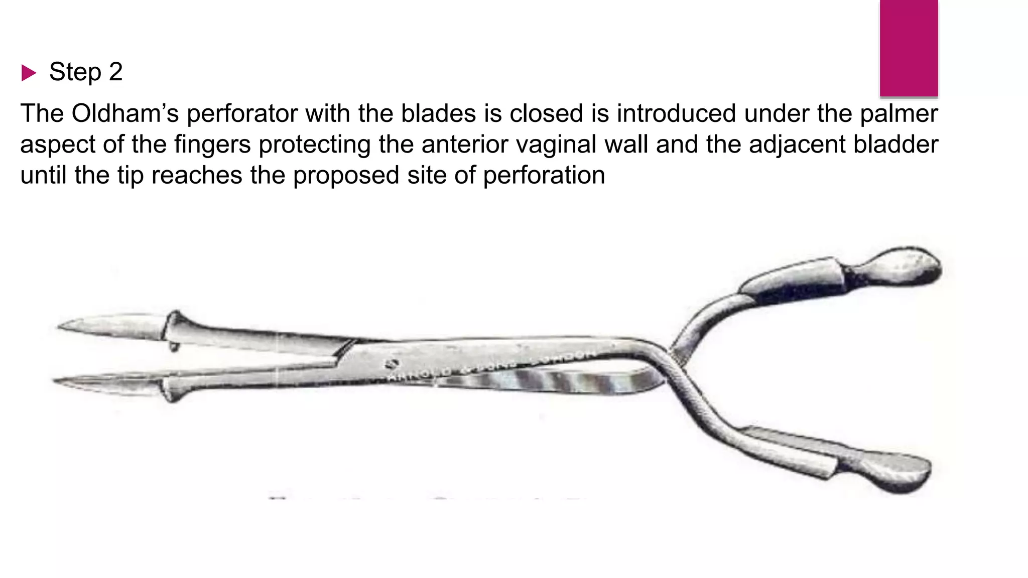 Destructive operations | PPTX