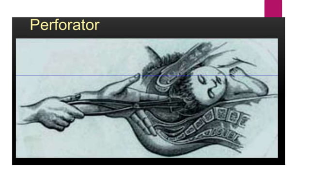 Destructive operations | PPTX | Pregnancy | Reproductive Health