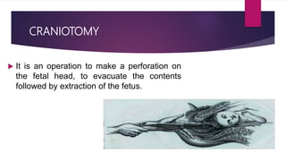 Destructive operations | PPTX