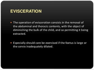 destructive operations.pptx