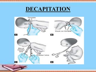 DESTRUCTIVE OPERATIONS.pptx
