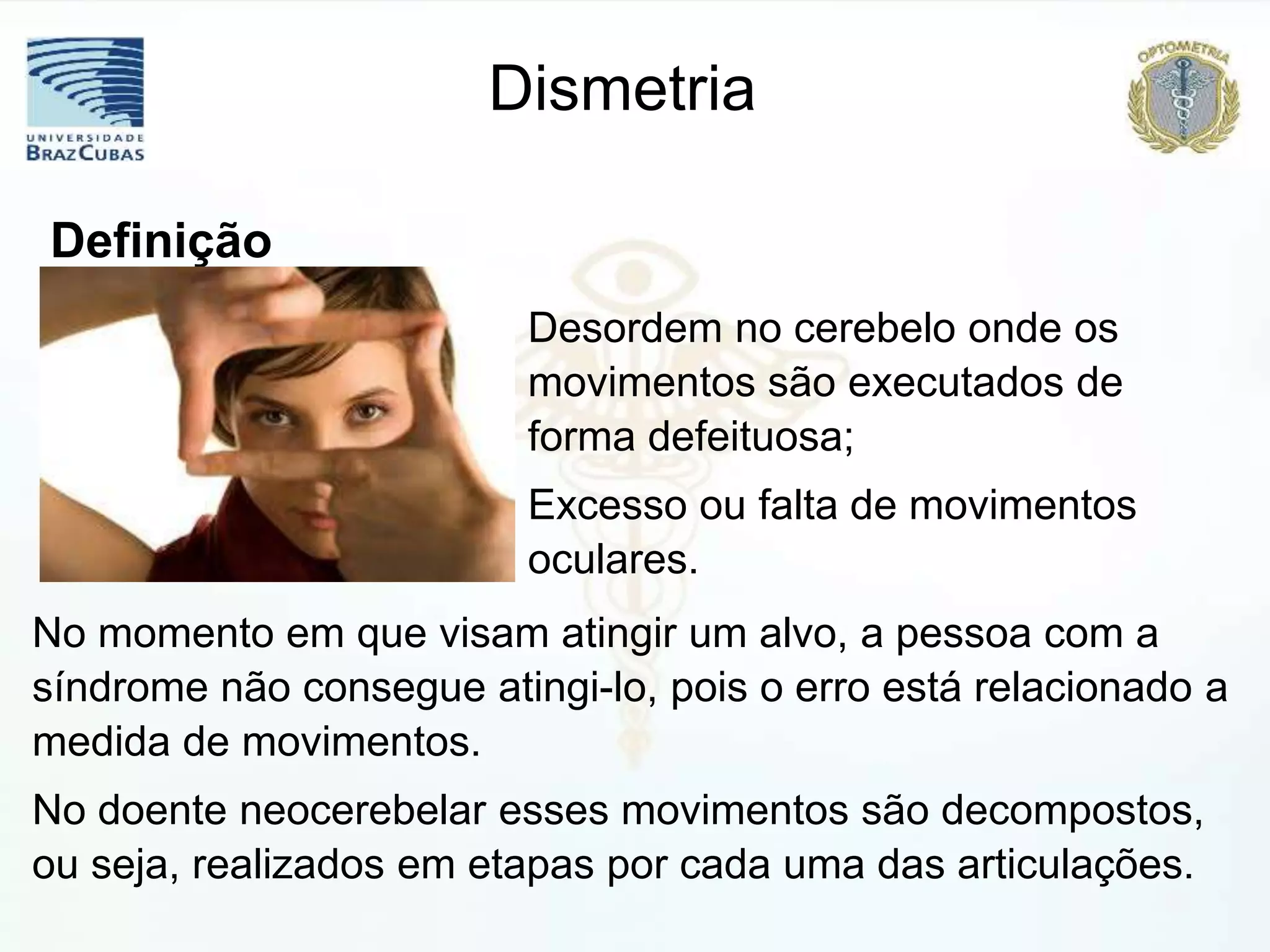 Desvio ocular,diplopia afacia dismetria | PPT