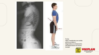 DESVIOS POSTURAIS DA COLUNA VERTEBRAL 0001.pptx