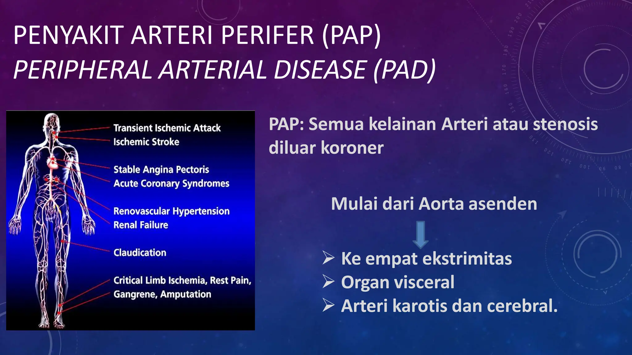 peripheral arterial disease_desyrusianaa | PPTX
