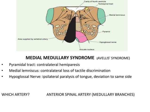 DETAILED ANATOMY OF THE MEDULLA | PPTX | Brain and Nervous System ...