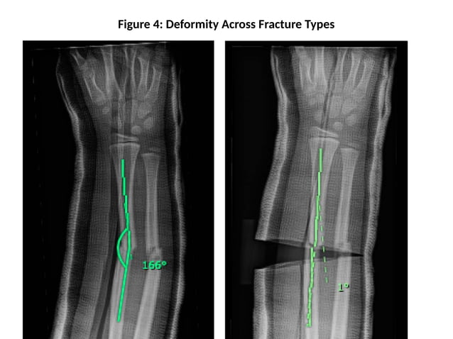 Detailed_Cast_Wedging_Presentation 2.pptx