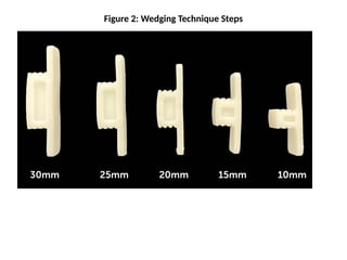 Detailed_Cast_Wedging_112Presentation.pptx