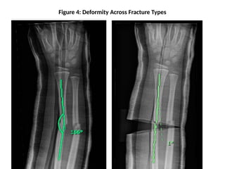 Detailed_Cast_Wedging_112Presentation.pptx