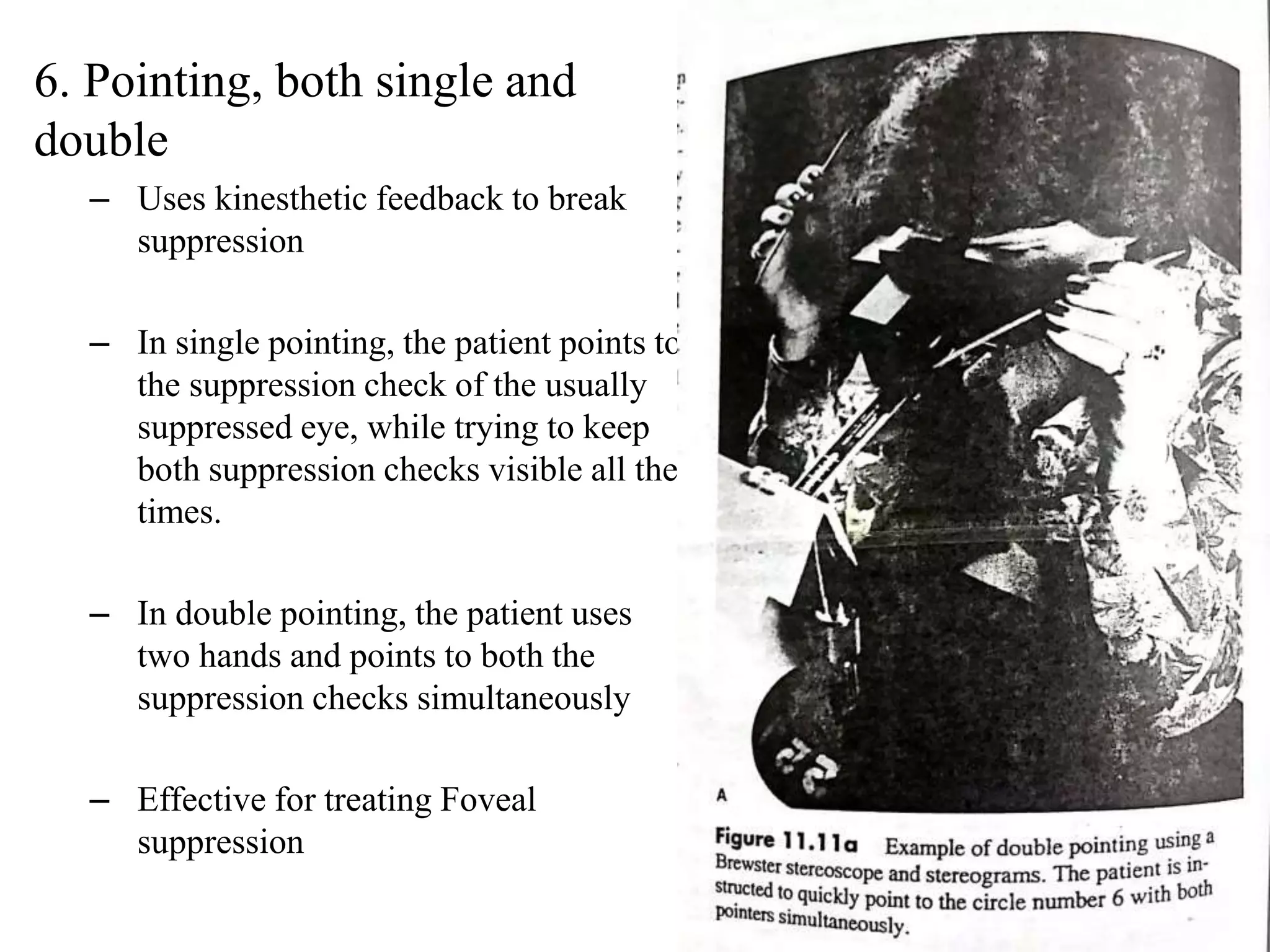 Detail of suppression and AC | PPTX
