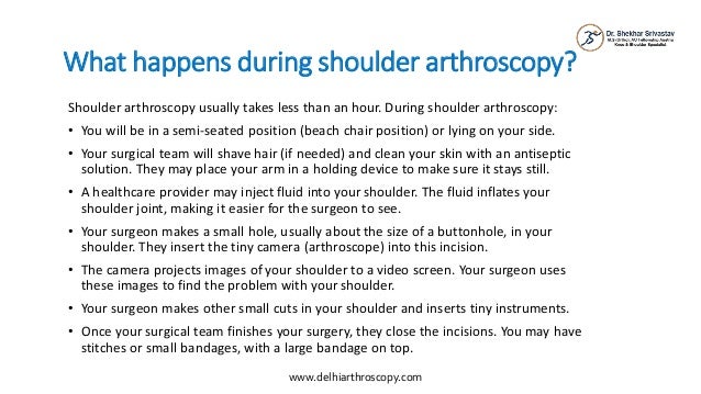 Details About Shoulder Arthroscopy | PDF