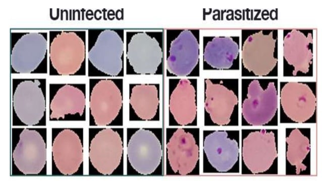 Detecting malaria using a deep convolutional neural network | PPTX Detecting malaria using a deep convolutional neural network | PPTX